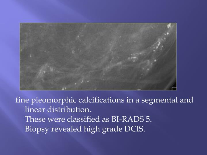 PPT - Breast Calcifications - Differential diagnosis and BIRADS ...