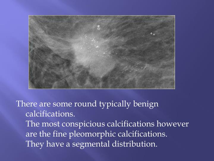 PPT - Breast Calcifications - Differential diagnosis and BIRADS ...