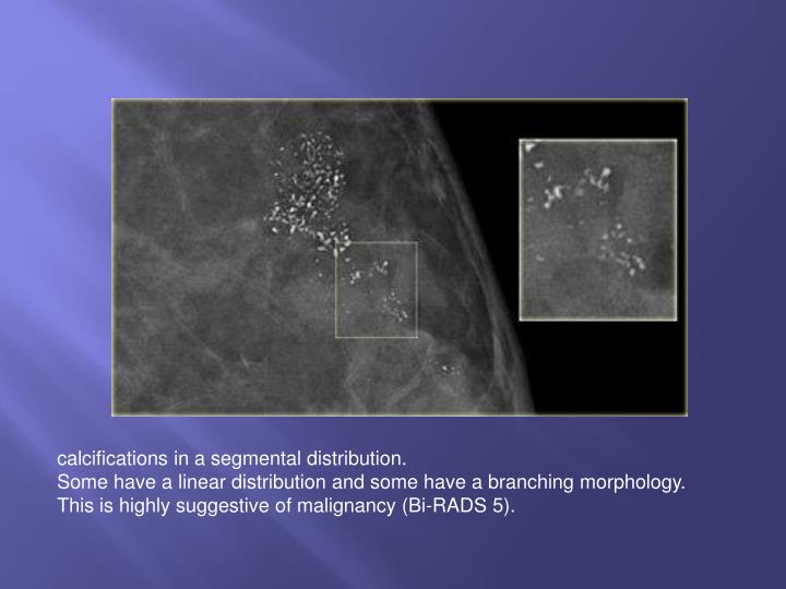 PPT - Breast Calcifications - Differential diagnosis and BIRADS ...