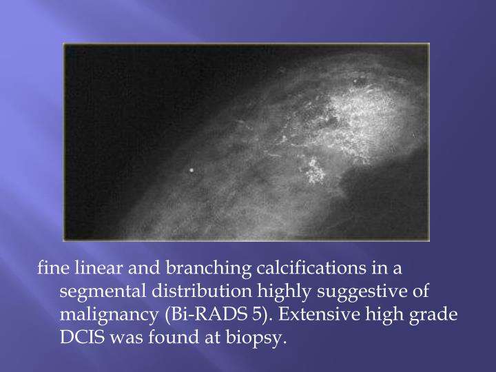PPT - Breast Calcifications - Differential diagnosis and BIRADS ...