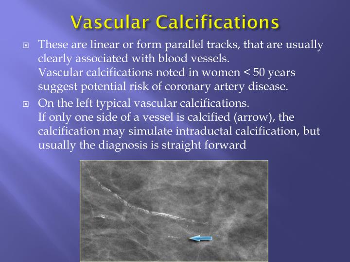 PPT - Breast Calcifications - Differential diagnosis and BIRADS ...