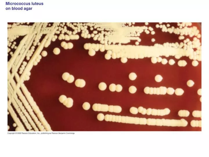 PPT - Micrococcus luteus on blood agar PowerPoint Presentation, free ...