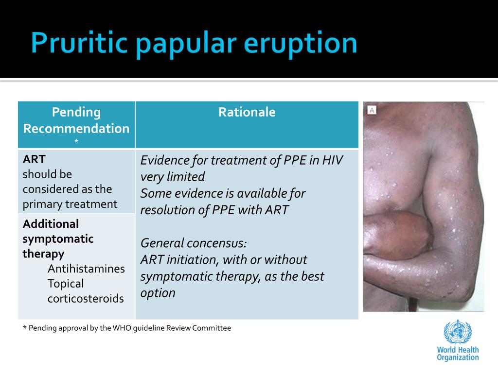 PPT - Guidelines on skin and oral HIV-associated conditions in children ...