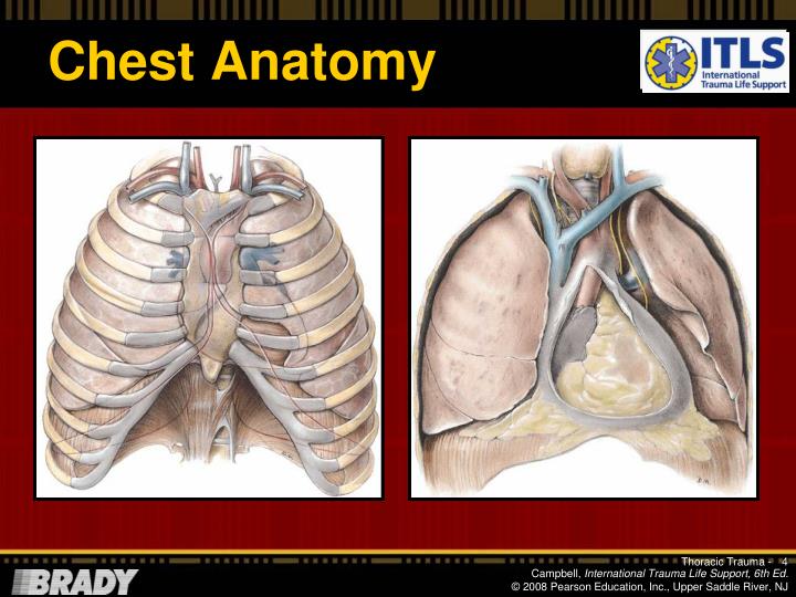 PPT - Chapter 6 Thoracic Trauma PowerPoint Presentation - ID:3719454