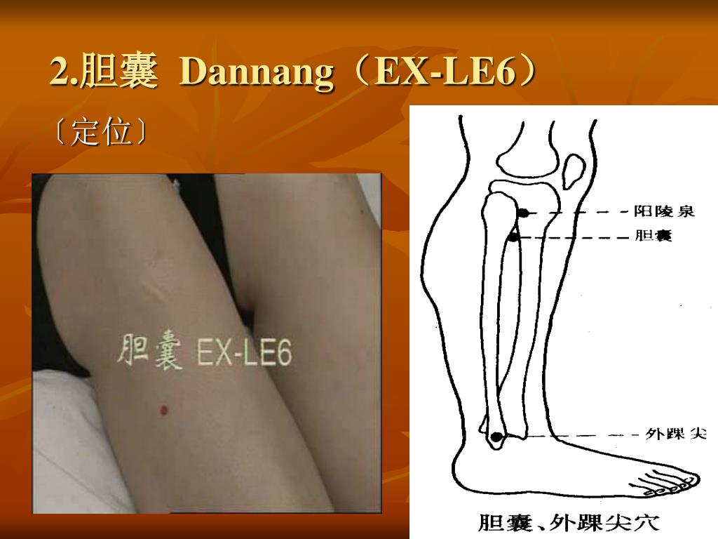 PPT - 第 四 节 常 用 奇 穴 Extra points ， EX PowerPoint Presentation - ID:3719656