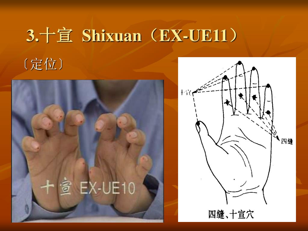 PPT - 第 四 节 常 用 奇 穴 Extra points ， EX PowerPoint Presentation - ID:3719656