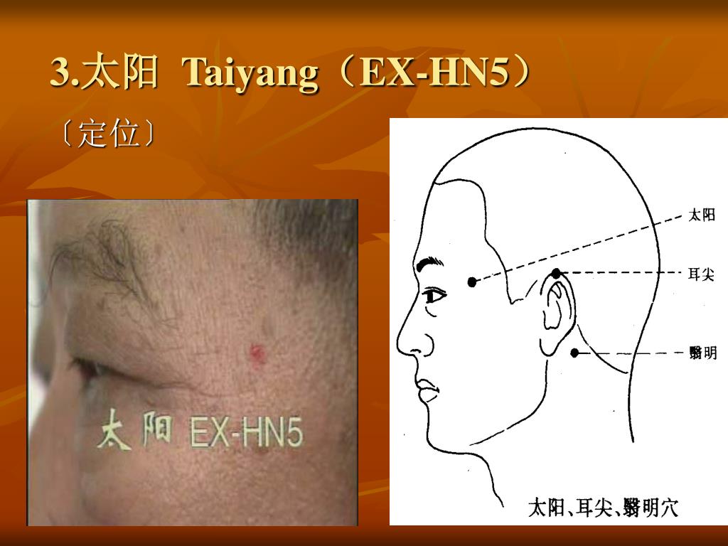PPT - 第 四 节 常 用 奇 穴 Extra points ， EX PowerPoint Presentation - ID:3719656