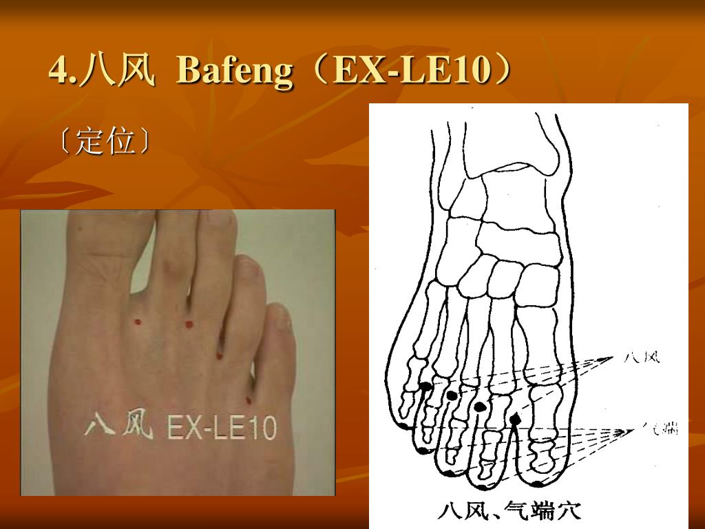 PPT - 第 四 节 常 用 奇 穴 Extra points ， EX PowerPoint Presentation - ID:3719656