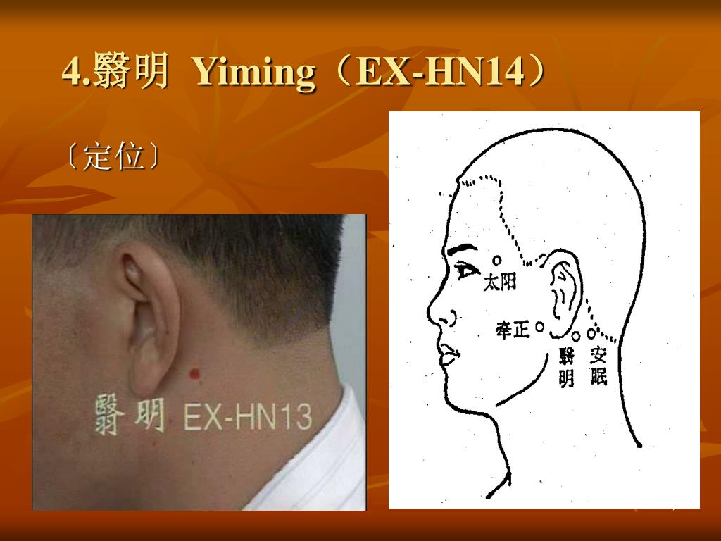PPT - 第 四 节 常 用 奇 穴 Extra points ， EX PowerPoint Presentation - ID:3719656