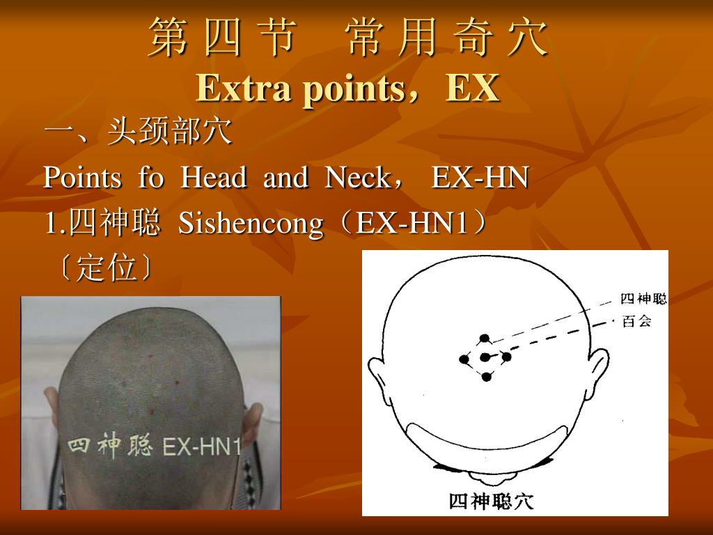 PPT - 第 四 节 常 用 奇 穴 Extra points ， EX PowerPoint Presentation - ID:3719656