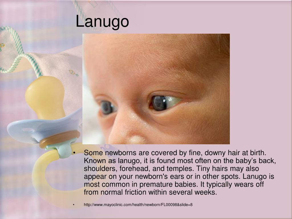 Lanugo Hair On Baby s Forehead Fluffums