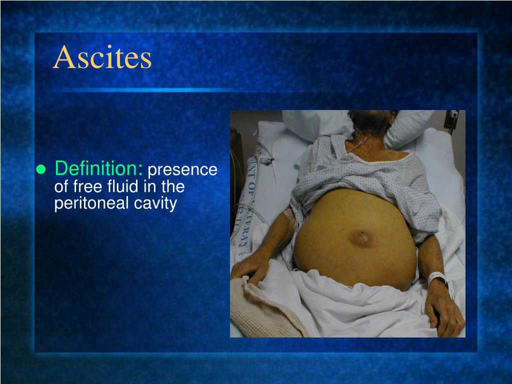 PPT - by Dr Intekhab Alam Professor of Medicine Department of Medicine ...