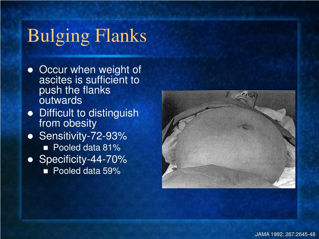 PPT - by Dr Intekhab Alam Professor of Medicine Department of Medicine ...