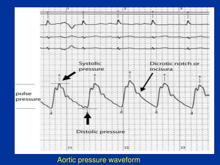 PPT - Cathlab hemodynamics – 1 pressures, waveforms ,cardiac output and ...