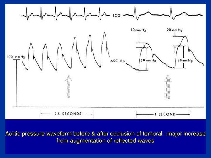 PPT - Cathlab hemodynamics – 1 pressures, waveforms ,cardiac output and ...