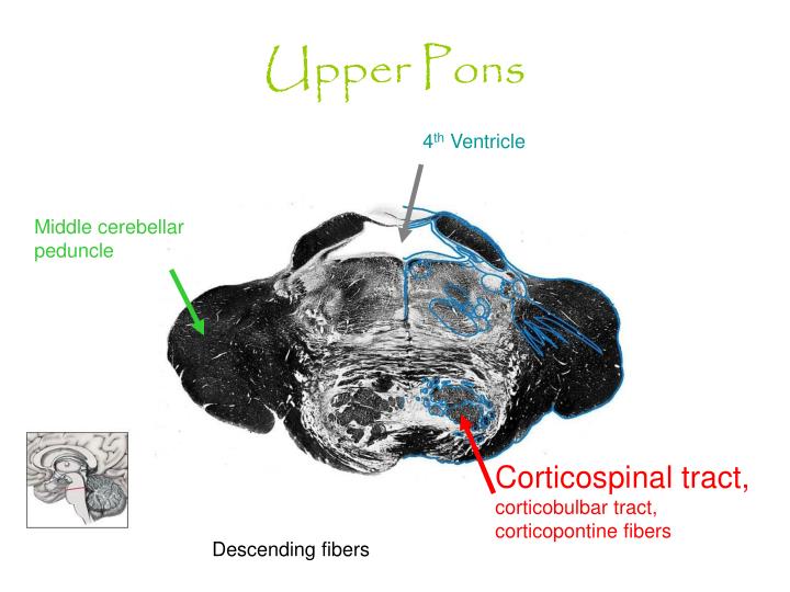 PPT - BRAINSTEM PowerPoint Presentation - ID:3735870