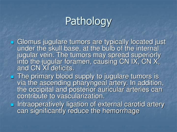 Ppt Glomus Jugular Tumor Powerpoint Presentation Id3735892