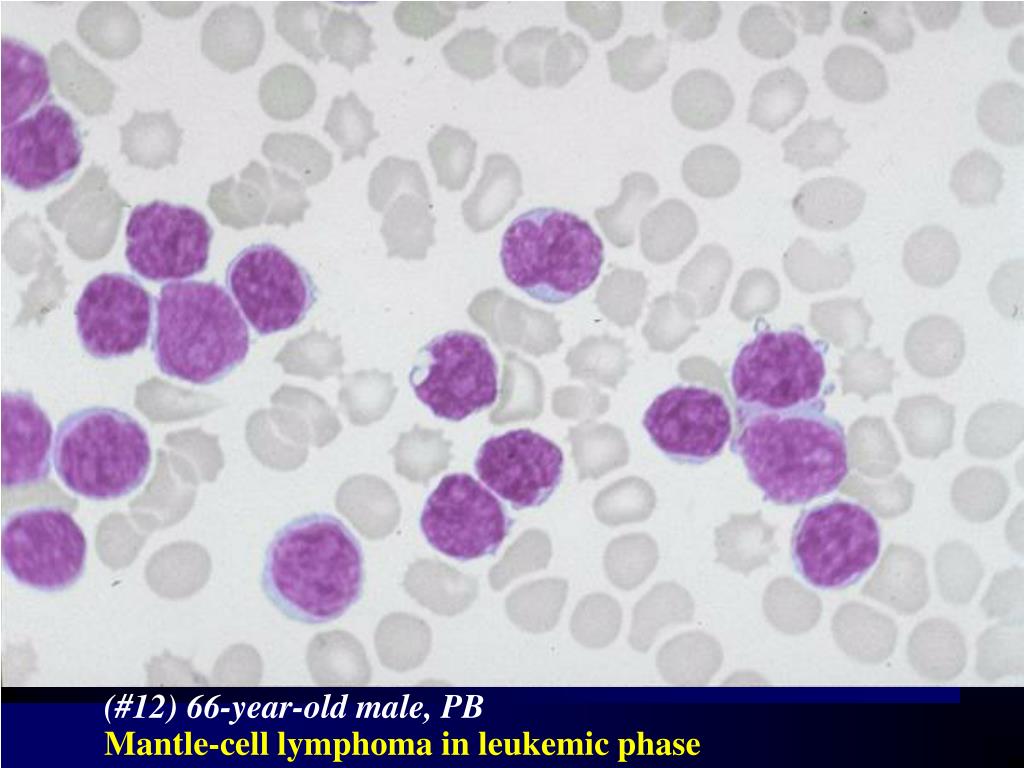 PPT - Morphology Review - ISH Slides - PowerPoint Presentation, free ... PPT - Morphology Review - ISH Slides - PowerPoint Presentation, free ...