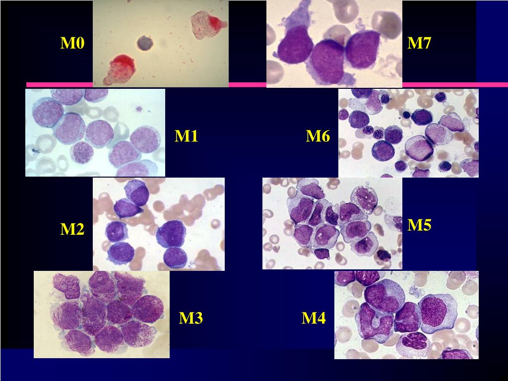 PPT - Morphology Review - ISH Slides - PowerPoint Presentation, free ... PPT - Morphology Review - ISH Slides - PowerPoint Presentation, free ...