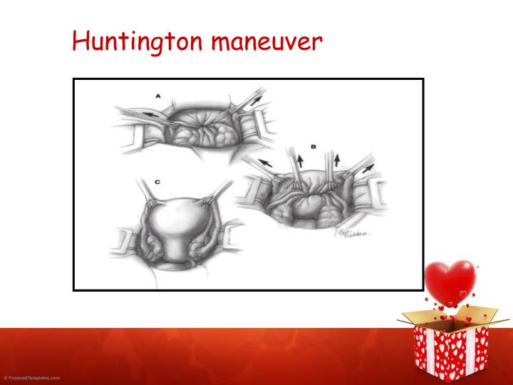 PPT - Postpartum Hemorrhage PowerPoint Presentation - ID:3739968