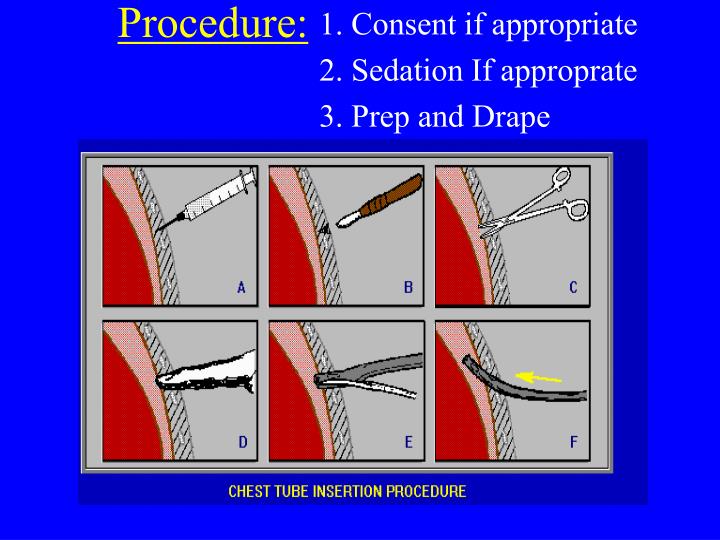 PPT - Chest Tube Insertion PowerPoint Presentation - ID:3740780