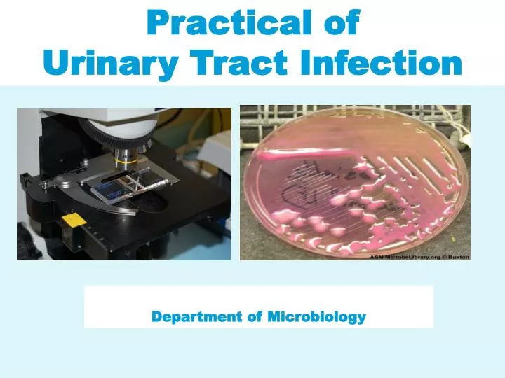 PPT - Practical of Urinary Tract Infection PowerPoint Presentation ...