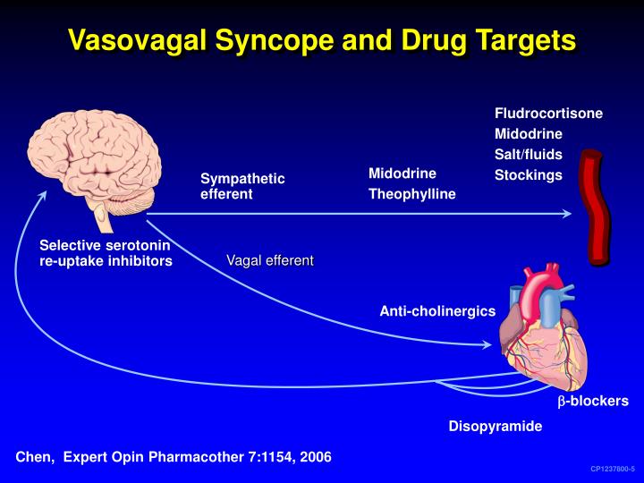 PPT - Syncope Low Back Pain of Cardiology!! PowerPoint Presentation ...