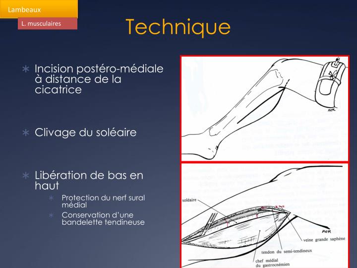 PPT - CAT devant une nécrose cutanée PowerPoint Presentation - ID:3746838
