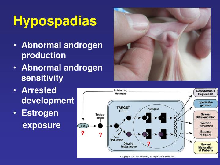 PPT - UROGENITAL TRACT Male Development PowerPoint Presentation - ID ...