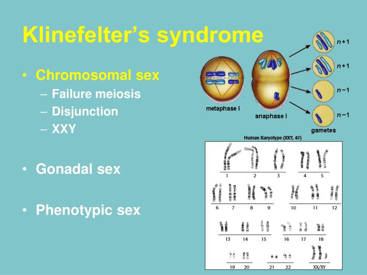 PPT - UROGENITAL TRACT Male Development PowerPoint Presentation - ID ...