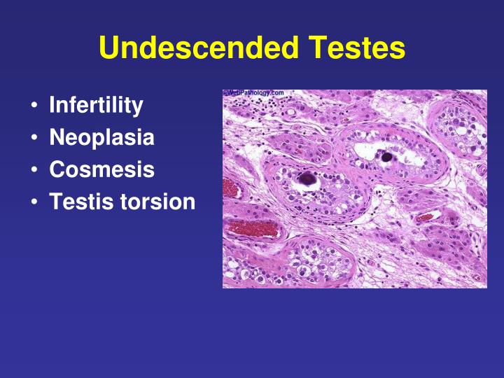 PPT - UROGENITAL TRACT Male Development PowerPoint Presentation - ID ...