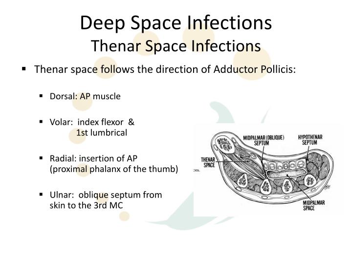 PPT - Hand Infections PowerPoint Presentation - ID:3753697