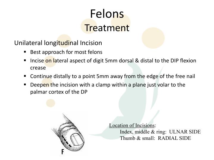 PPT - Hand Infections PowerPoint Presentation - ID:3753697