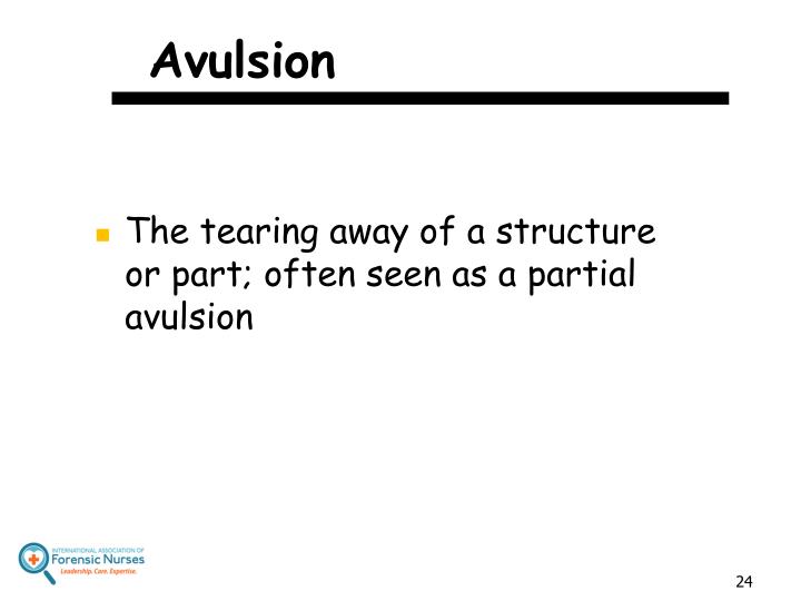 PPT - Assessing Patients for Signs of Elder Mistreatment PowerPoint ...