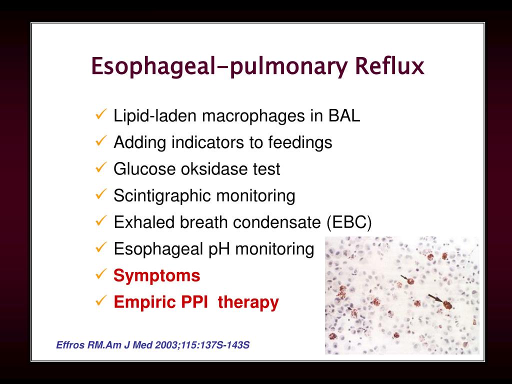 PPT - GASTROESOPHAGEAL REFLUX DISEASES PowerPoint Presentation, free ...
