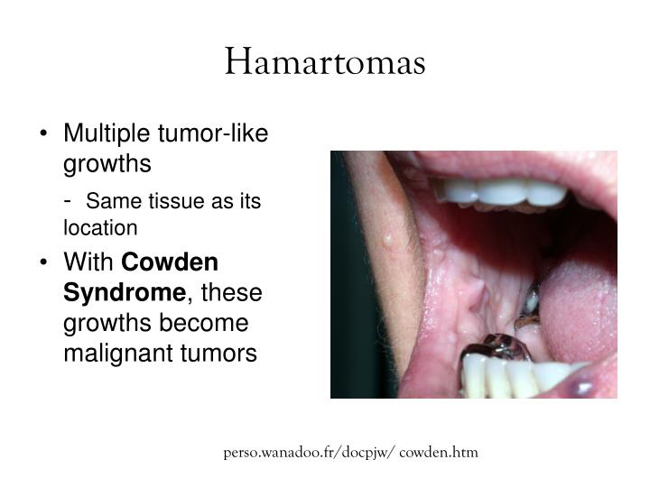 PPT - PTEN (Cowden Syndrome) PowerPoint Presentation - ID:3764267