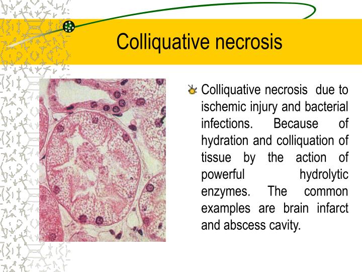 PPT - Cell damage: necrosis, apoptosis. General D eath PowerPoint ...