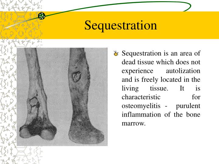 PPT - Cell damage: necrosis, apoptosis. General D eath PowerPoint ...