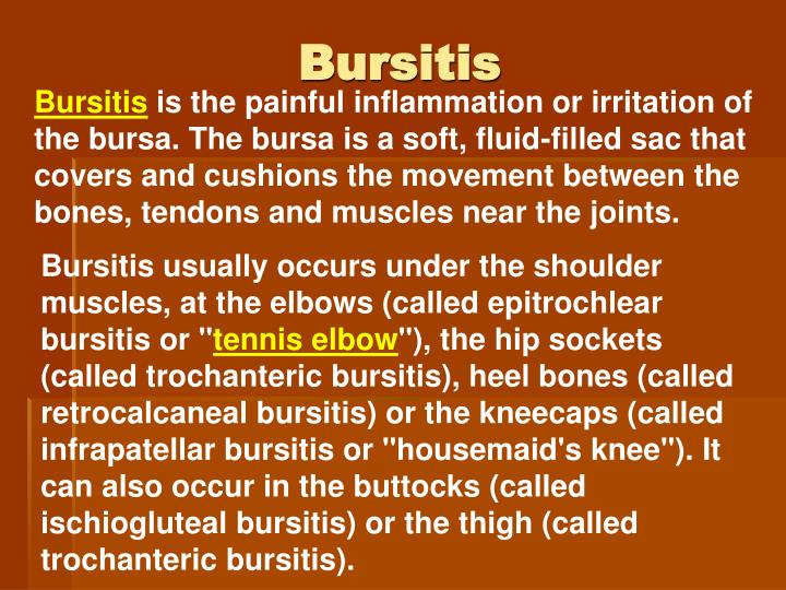 PPT - Joints! PowerPoint Presentation - ID:3772670