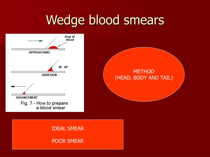 PPT - Preparation of Blood films (Making, Fixing & Staining technique ...