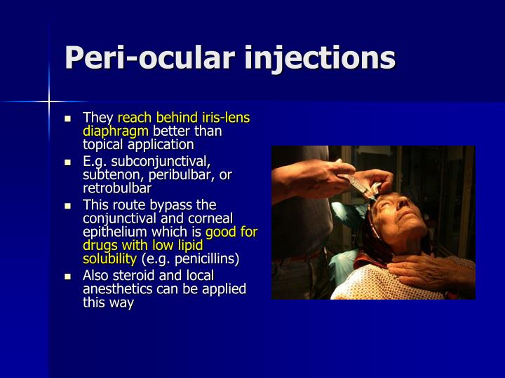 PPT - Ocular pharmacology and toxicology PowerPoint Presentation - ID ...