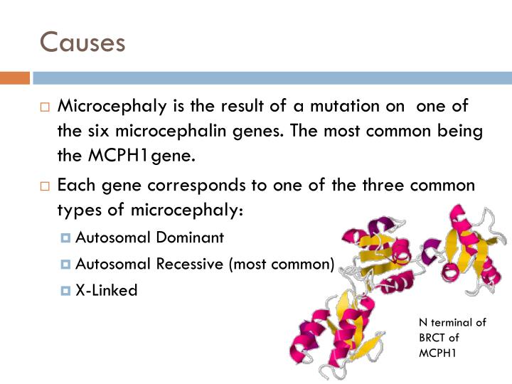 PPT - MICROCEPHALY PowerPoint Presentation - ID:3780061
