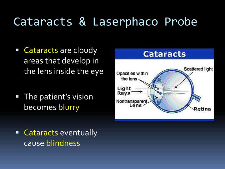 PPT - Patricia E. Bath PowerPoint Presentation - ID:3782659
