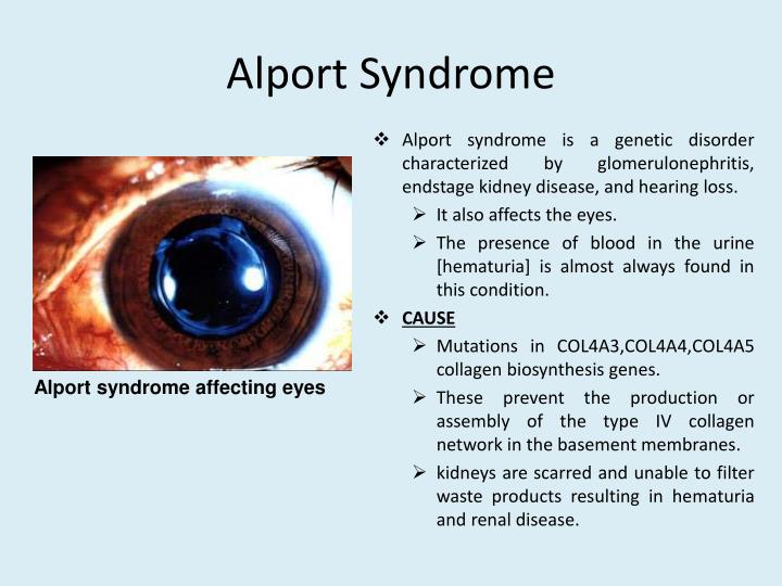 PPT - CONNECTIVE TISSUE PowerPoint Presentation - ID:3787471