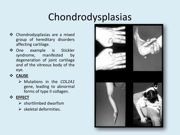 PPT - CONNECTIVE TISSUE PowerPoint Presentation - ID:3787471