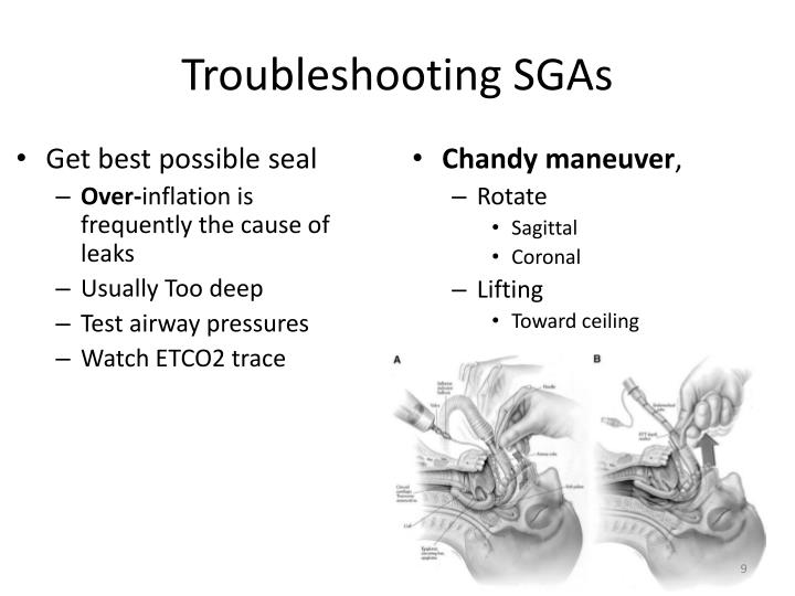 PPT - #3 Intro to EM Airway Management- Assessment and SupraGlottic ...