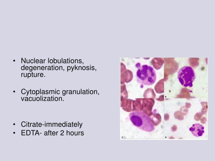 PPT - Romanowsky stains and Artefacts in blood films PowerPoint ...
