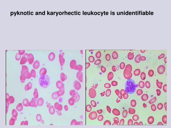 PPT - Romanowsky stains and Artefacts in blood films PowerPoint ...