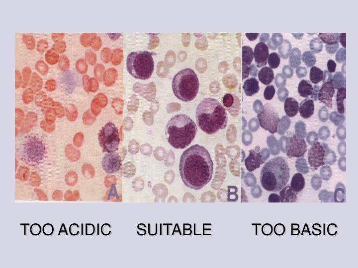 PPT - Romanowsky stains and Artefacts in blood films PowerPoint ...