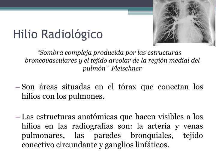 PPT - Anatomía Hiliar Pulmonar PowerPoint Presentation - ID:3793267